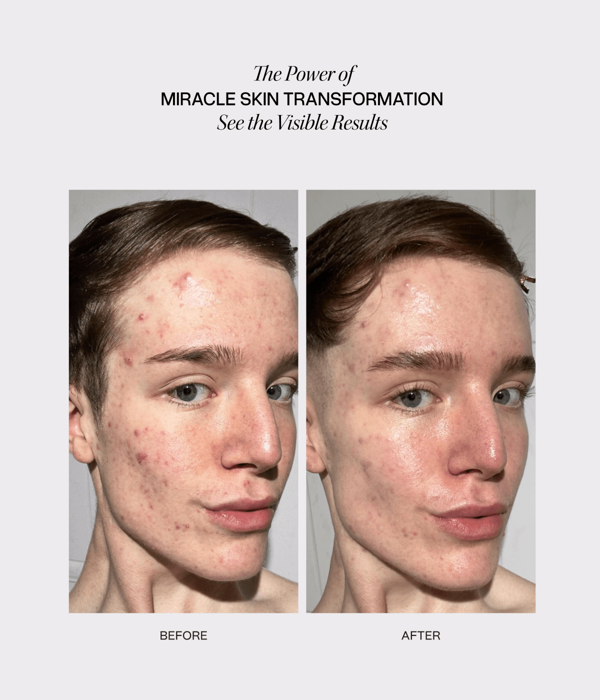 Miracle Skin Transformation – Cosmetic Consult
